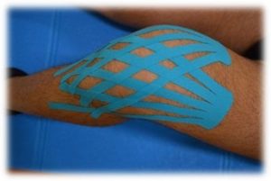 Sinovitis de Rodilla | Tratamiento con Fisioterapia Tlalne